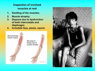 Inflammatory Periarticular Lesions Lecture 3 | PPT