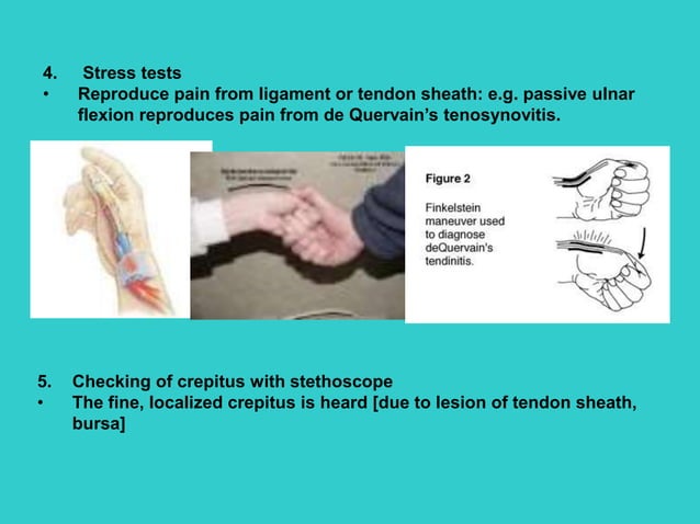 Inflammatory Periarticular Lesions Lecture 3 | PPT