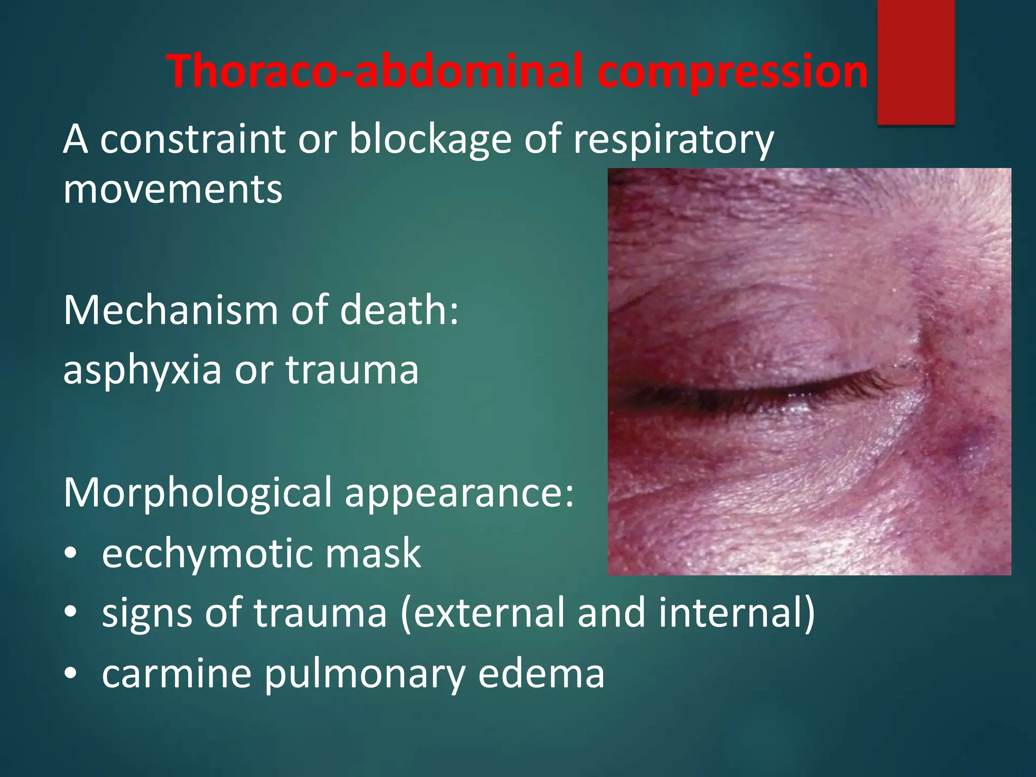 Lecture 3. Forensic examination of mechanical asphyxia.ppt