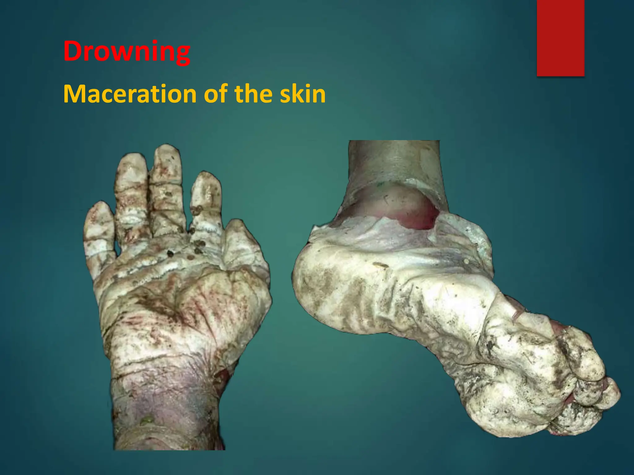 Lecture 3. Forensic examination of mechanical asphyxia.ppt