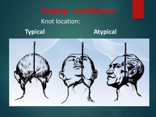 Lecture 3. Forensic examination of mechanical asphyxia.ppt
