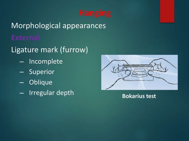 Lecture 3. Forensic examination of mechanical asphyxia.ppt