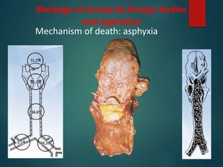 Lecture 3. Forensic examination of mechanical asphyxia.ppt