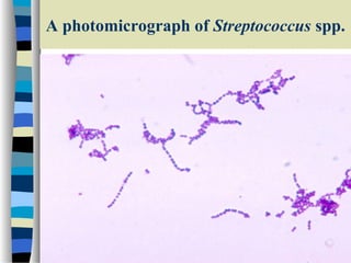 Streptococcus Pyogenes Slide
