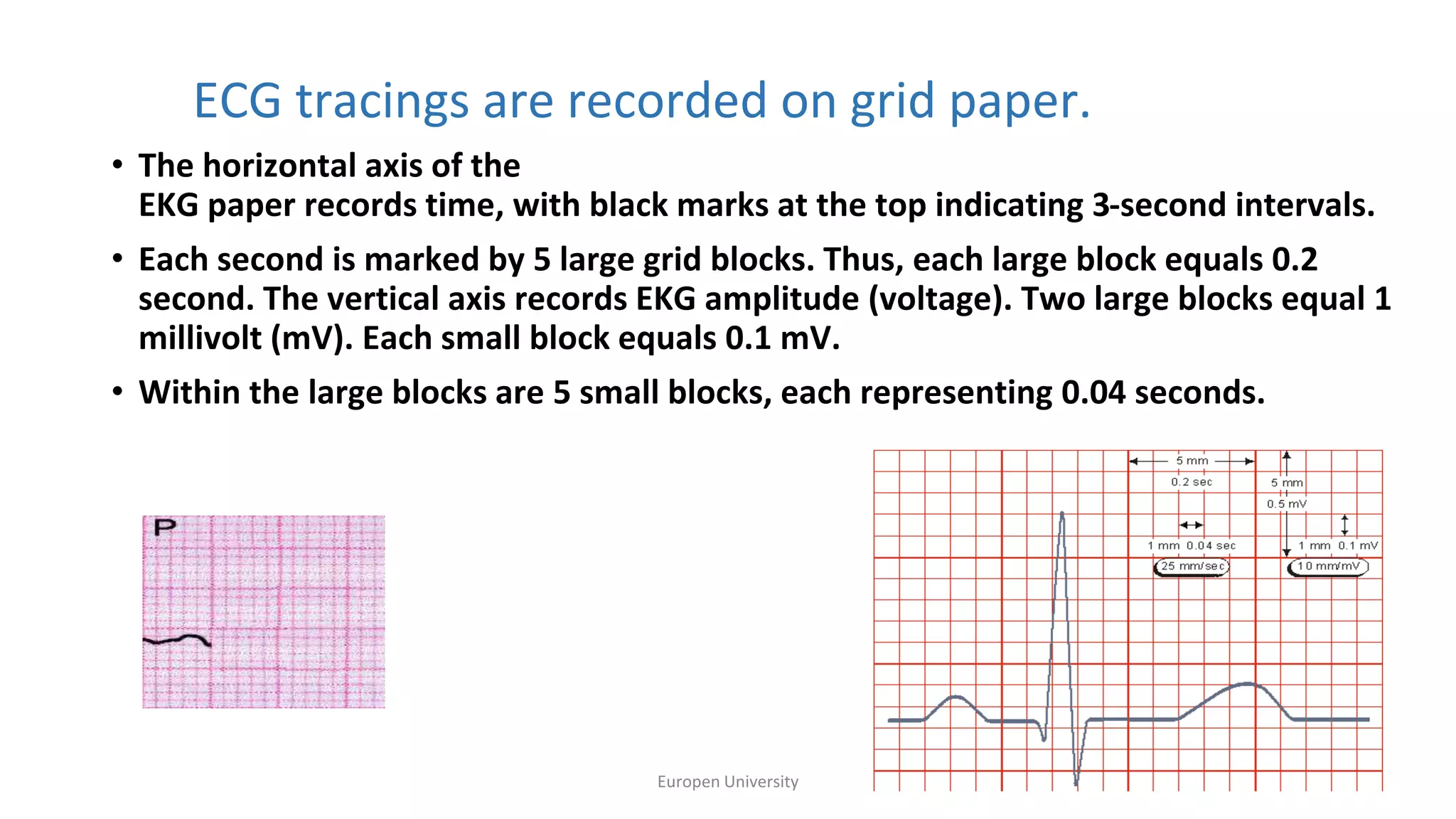 Lecture 3 - taking -ecg.pptx