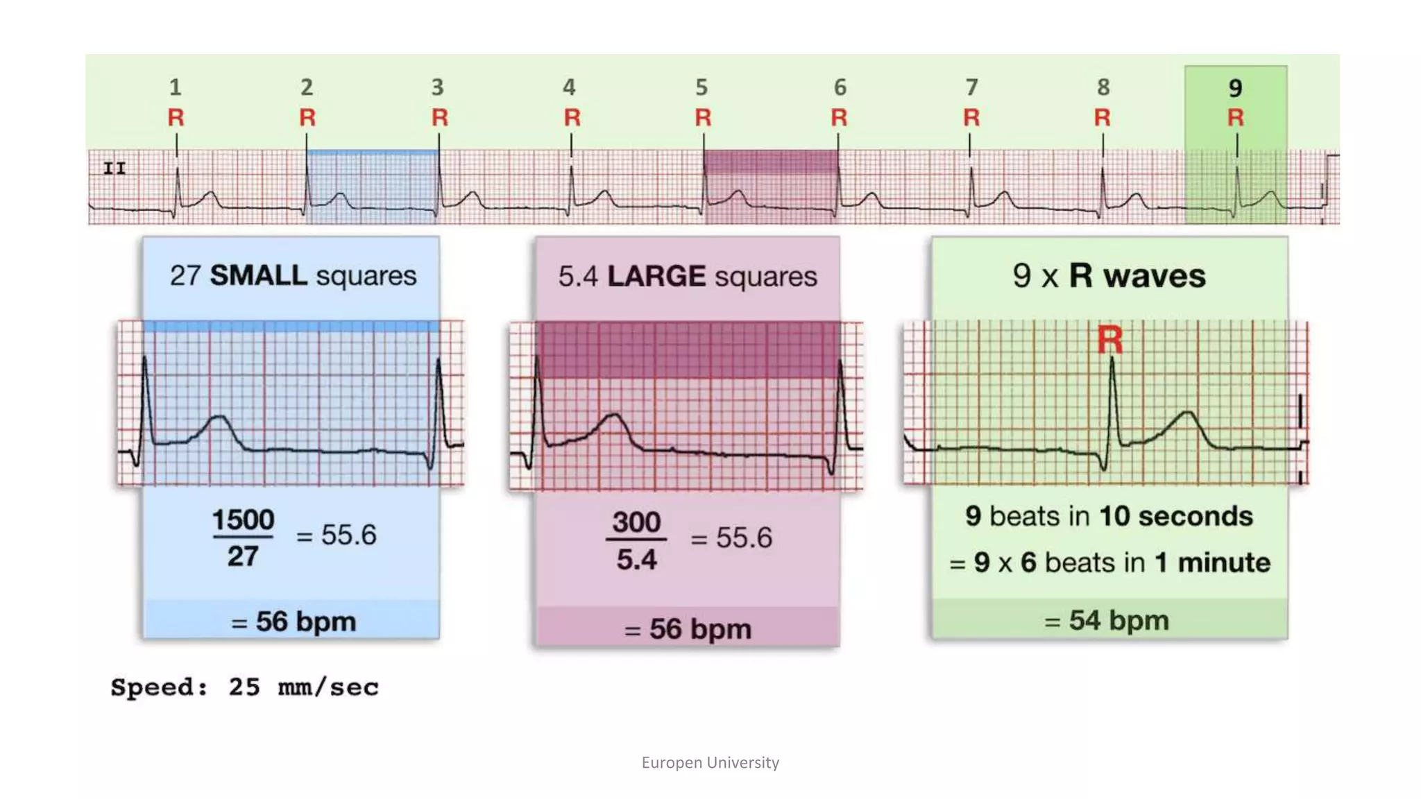 Lecture 3 - taking -ecg.pptx