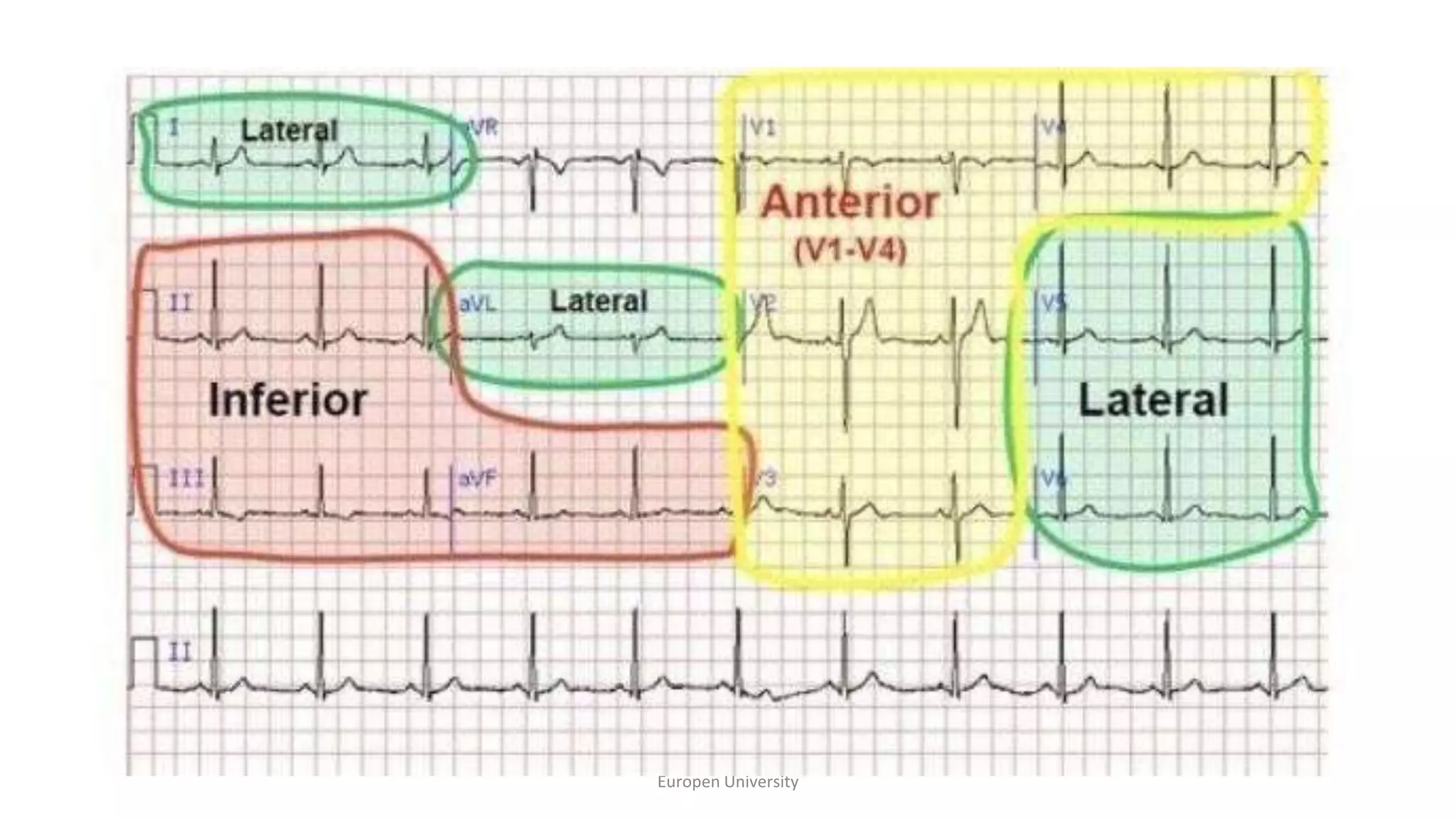 Lecture 3 - taking -ecg.pptx