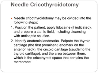 Lecture 30. CRICOTHYROIDOTOMY.pptxzbendj | PPTX