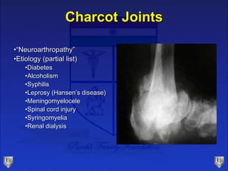 Charcot Joint Syphilis