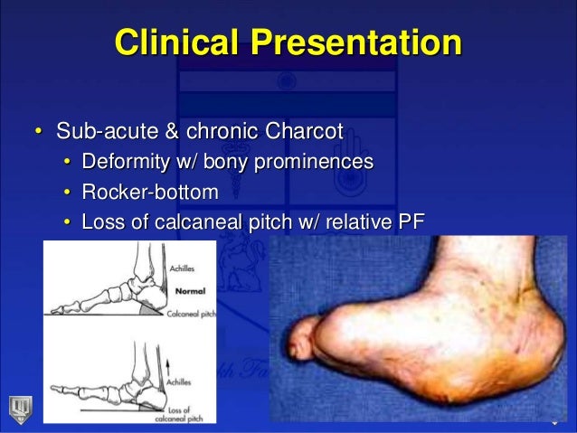 Lecture 30 parekh charcot