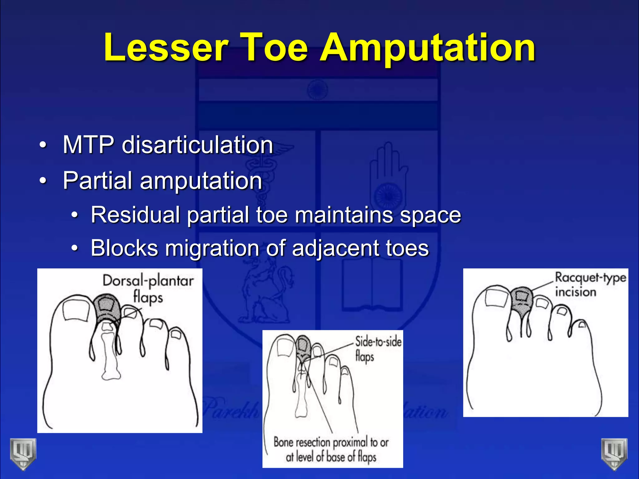 Lecture 31 parekh amputations | PPTX