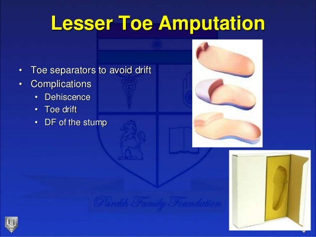 Lecture 31 parekh amputations