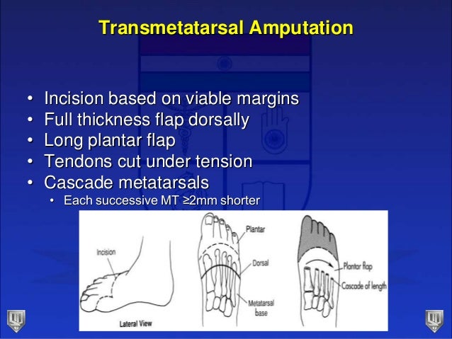 Lecture 31 parekh amputations