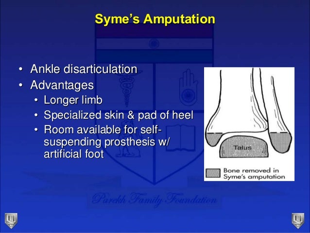 Lecture 31 parekh amputations