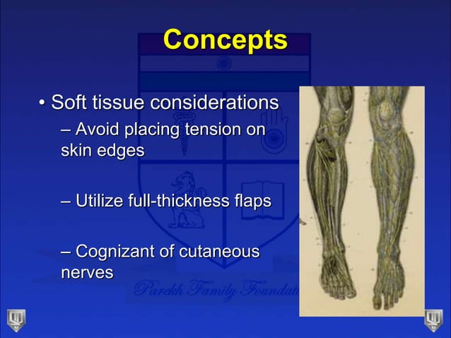 Lecture 33 34 Parekh Ankle Arthritis Ppt