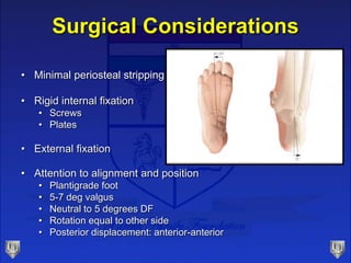 Lecture 33 34 parekh ankle arthritis | PPTX