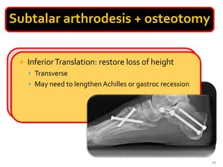 Lecture 35 shah subtalar fusion | PPTX