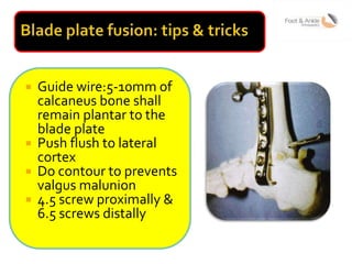 Lecture 37 shah ttc fusion | PPTX