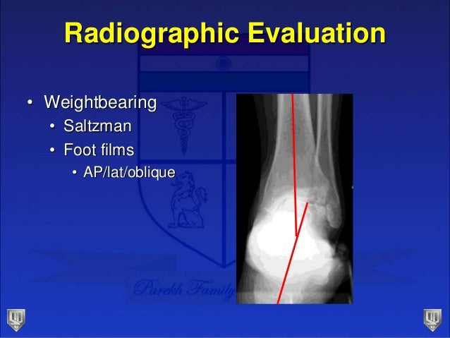 Lecture 39 parekh tar