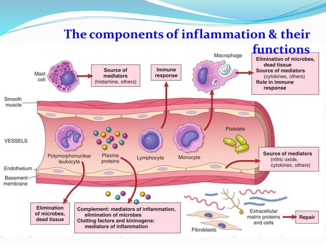 Lecture 3 Acute inflammation definition, events, signs and ...
