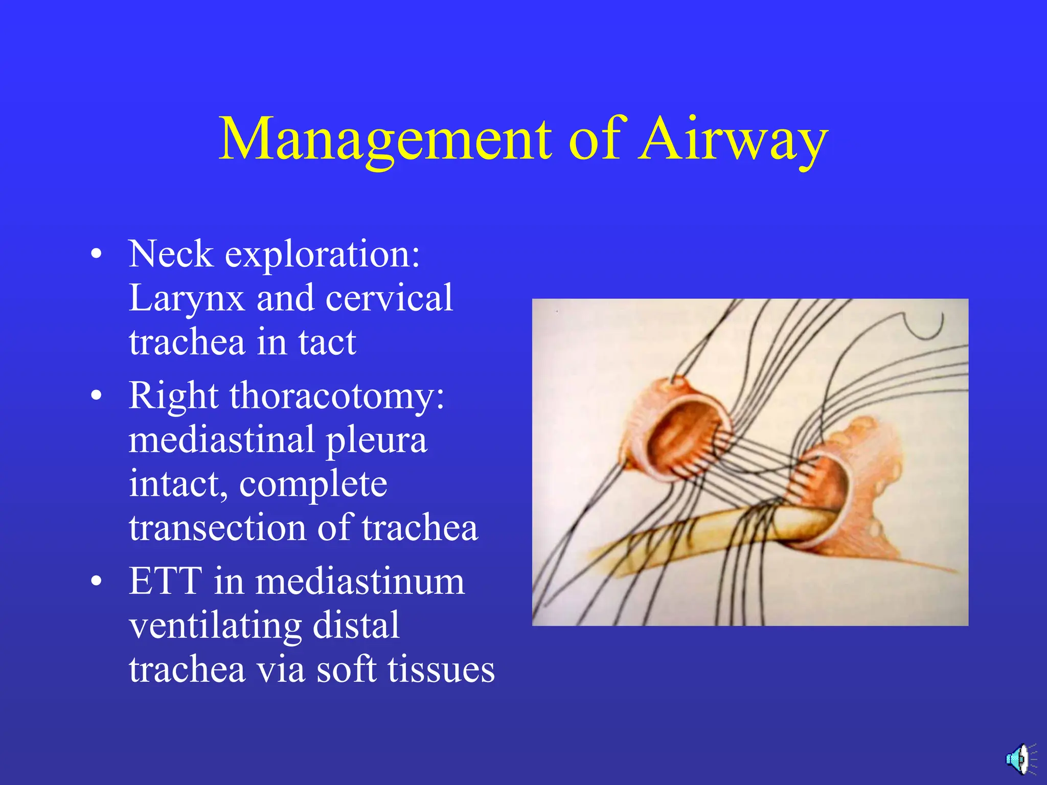 lecture 3 airway management.pdf education | PDF | Lung and Respiratory ...