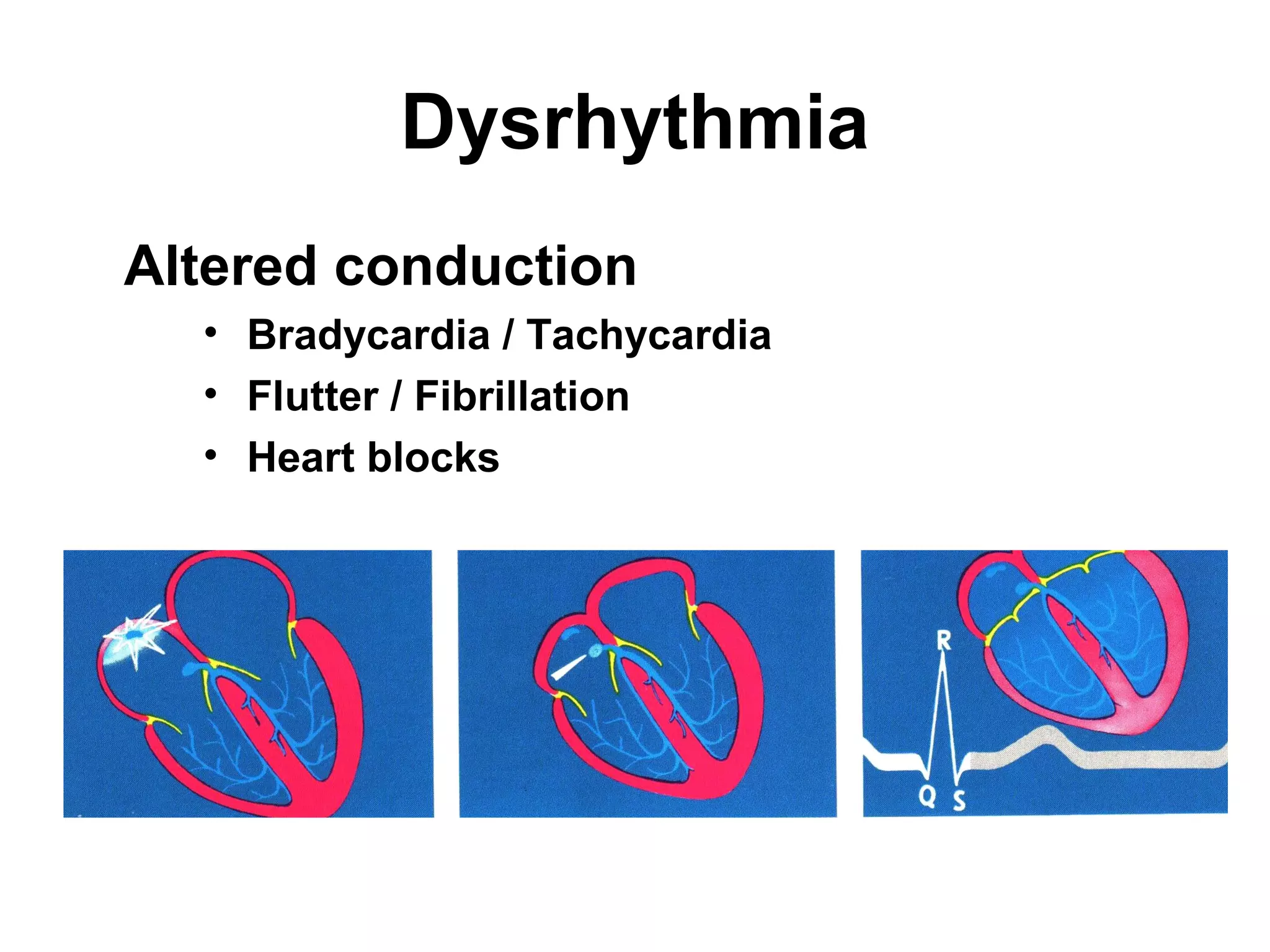 Lecture 3 cardiac rhythms | PPT
