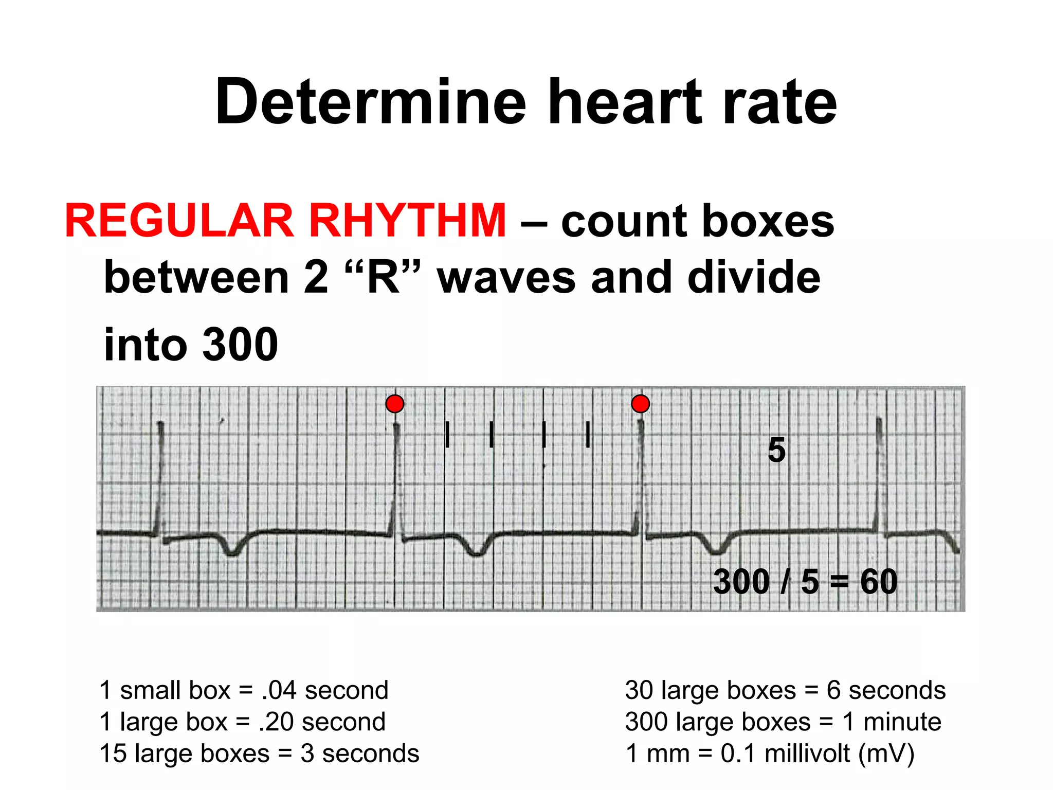 Lecture 3 cardiac rhythms | PPT