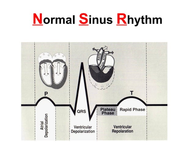 Lecture 3 cardiac rhythms | PPT