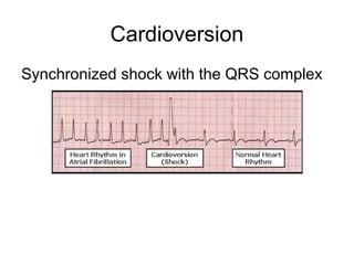 Lecture 3 cardiac rhythms | PPT