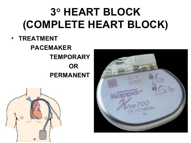 Lecture 3 cardiac rhythms