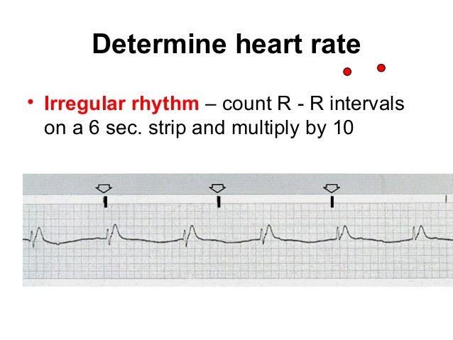 Lecture 3 cardiac rhythms