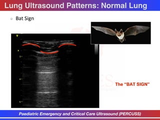 Paediatric Emergency and Critical Care Ultrasound - Lung Ultrasound | PDF