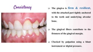 GINGIVA Macroscopic features | PPTX