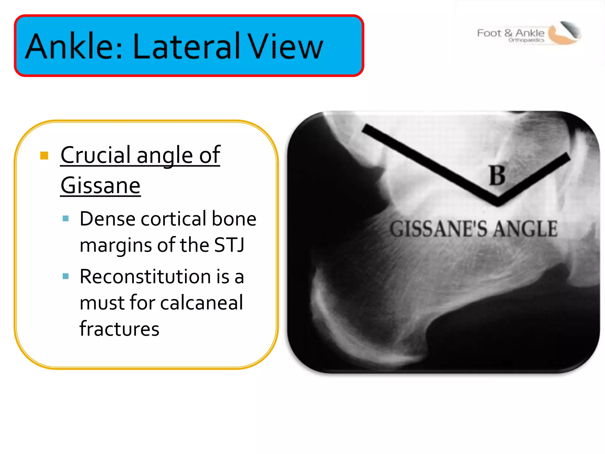 Lecture 3 shah radiology in foot and ankle | PPTX