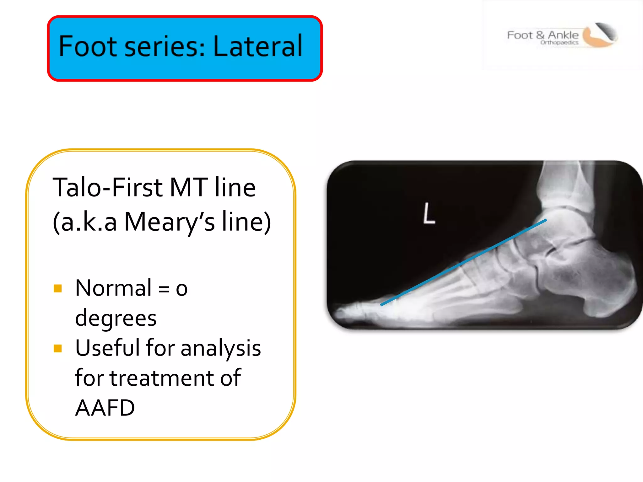 Lecture 3 shah radiology in foot and ankle | PPTX
