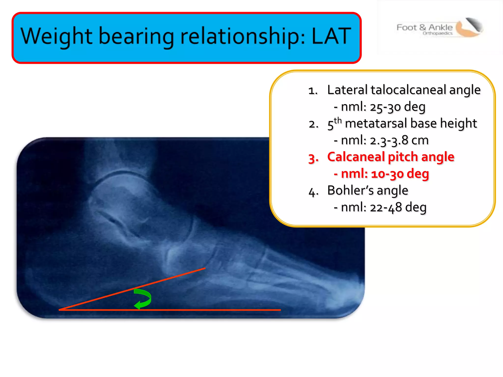 Lecture 3 shah radiology in foot and ankle | PPTX
