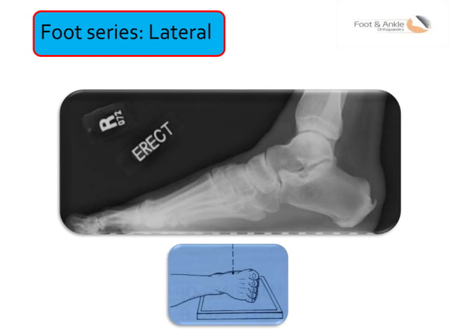 Lecture 3 shah radiology in foot and ankle | PPTX