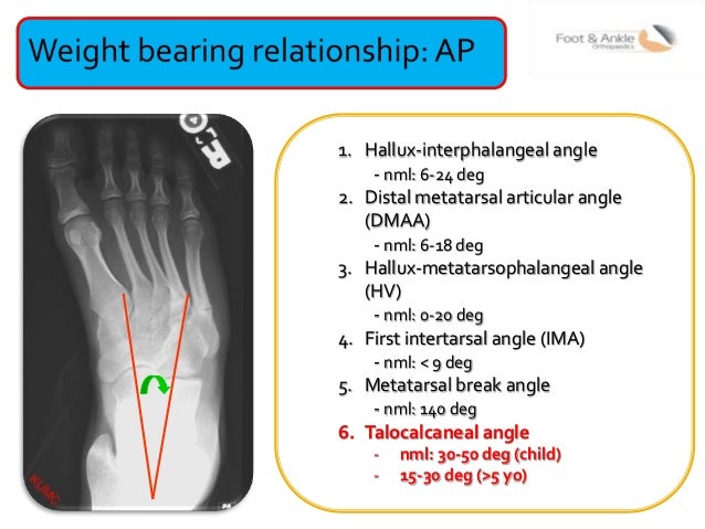 Lecture 3 shah radiology in foot and ankle