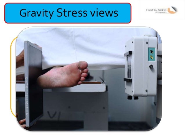 Lecture 3 shah radiology in foot and ankle