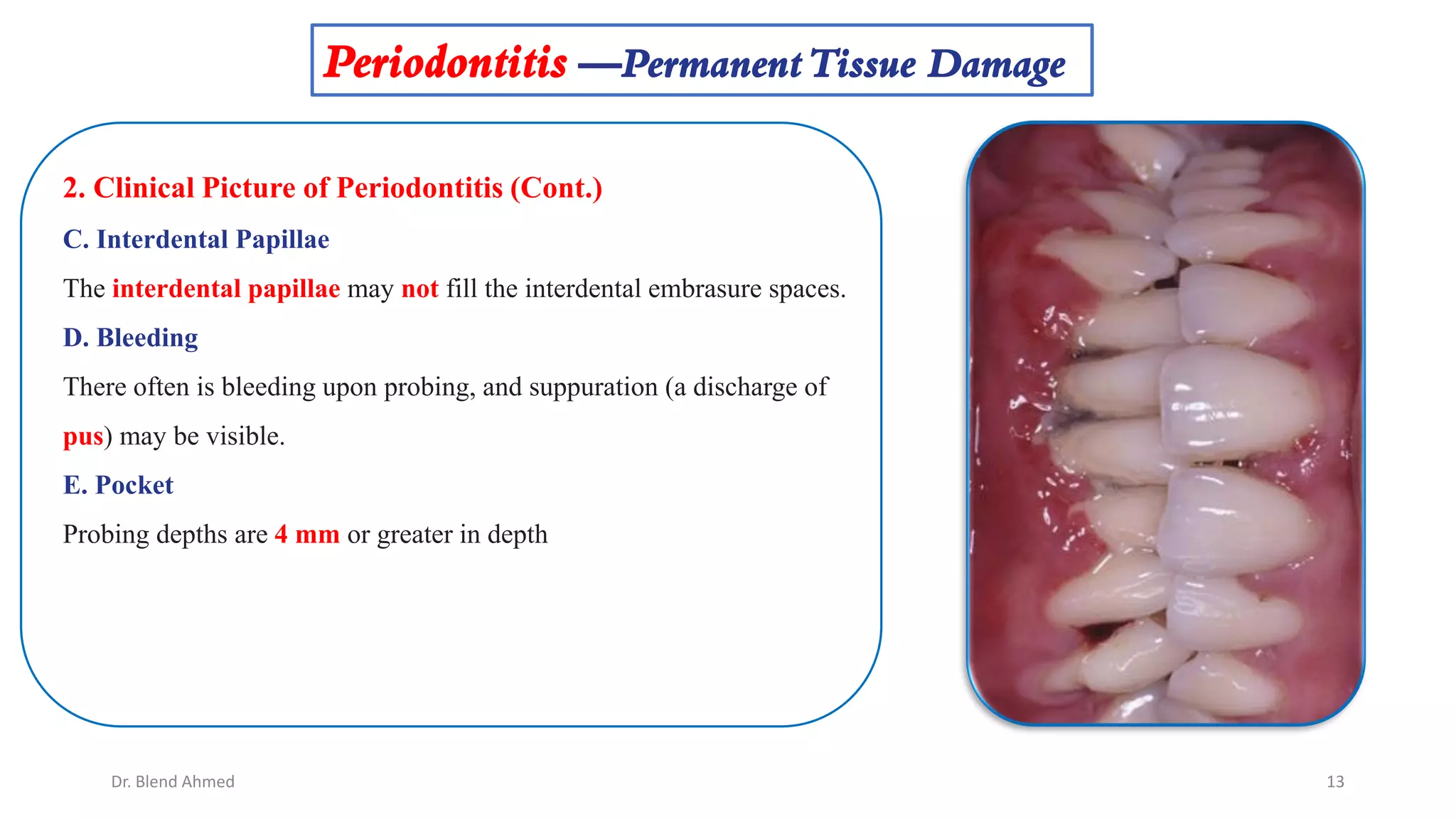 Periodontium in Health and Disease | PDF