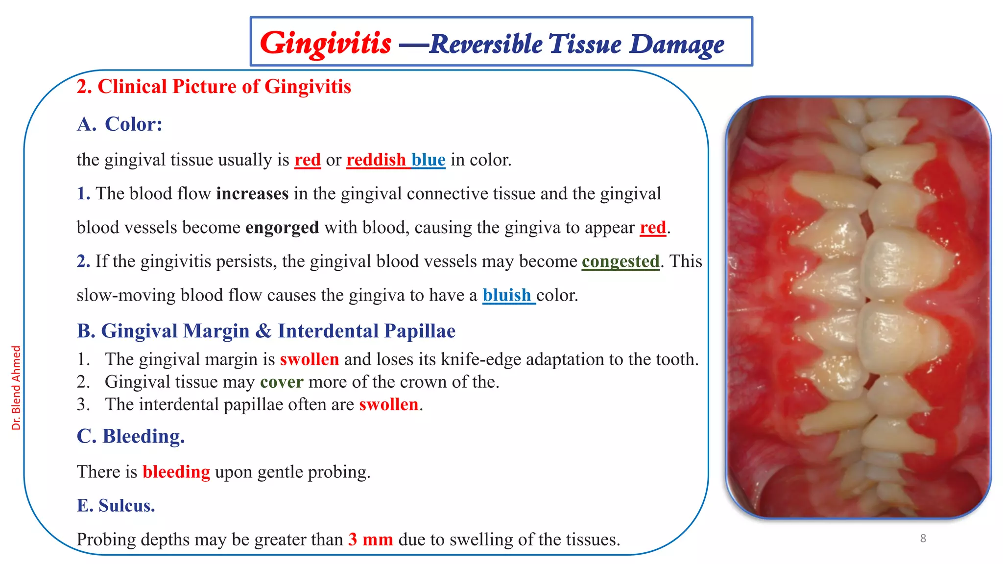 Periodontium in Health and Disease | PDF