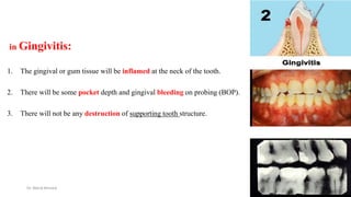 Periodontium in Health and Disease | PDF
