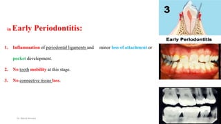 Periodontium in Health and Disease | PDF