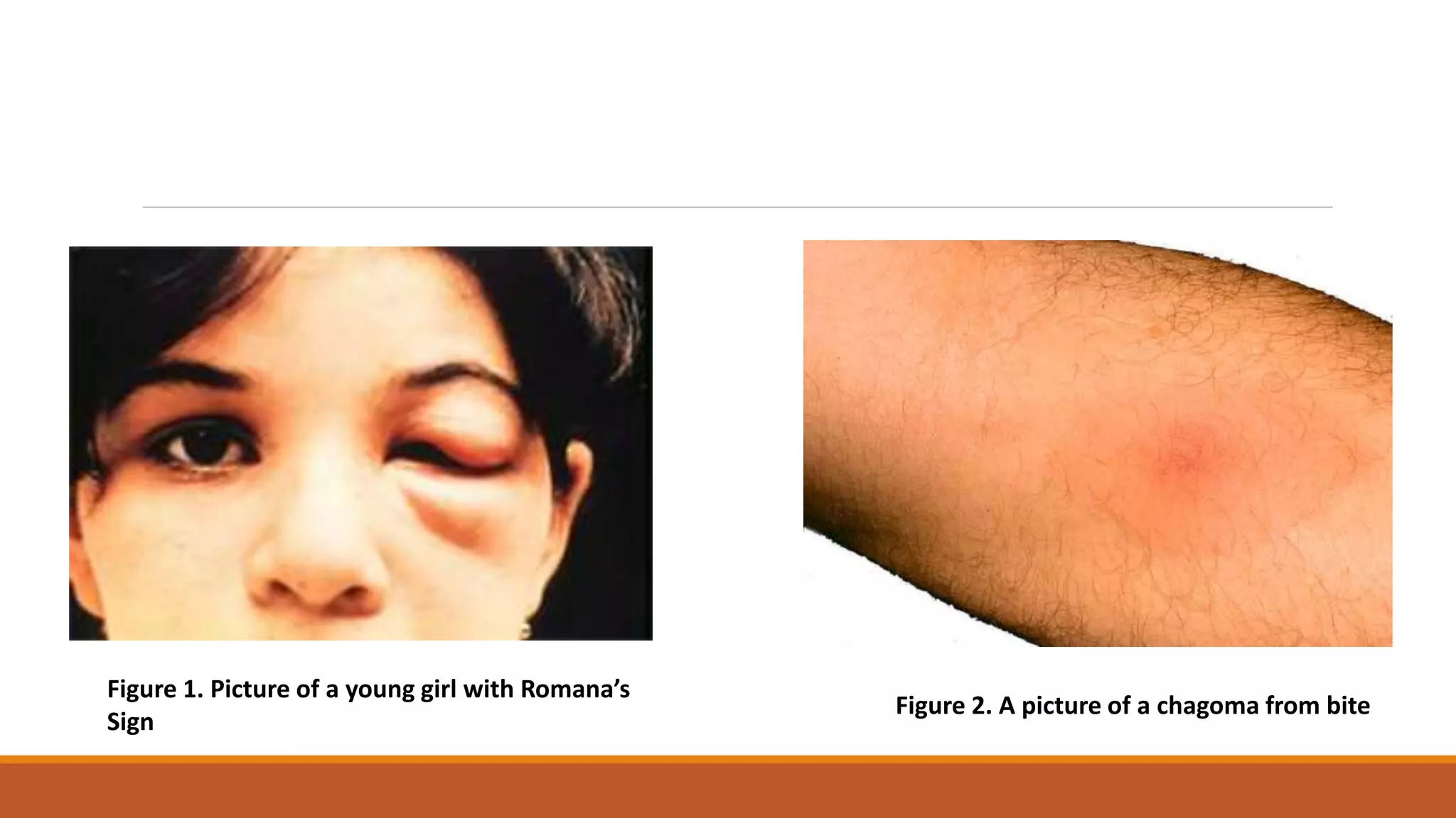 Lecture 3 (T. cruzi) .pptx