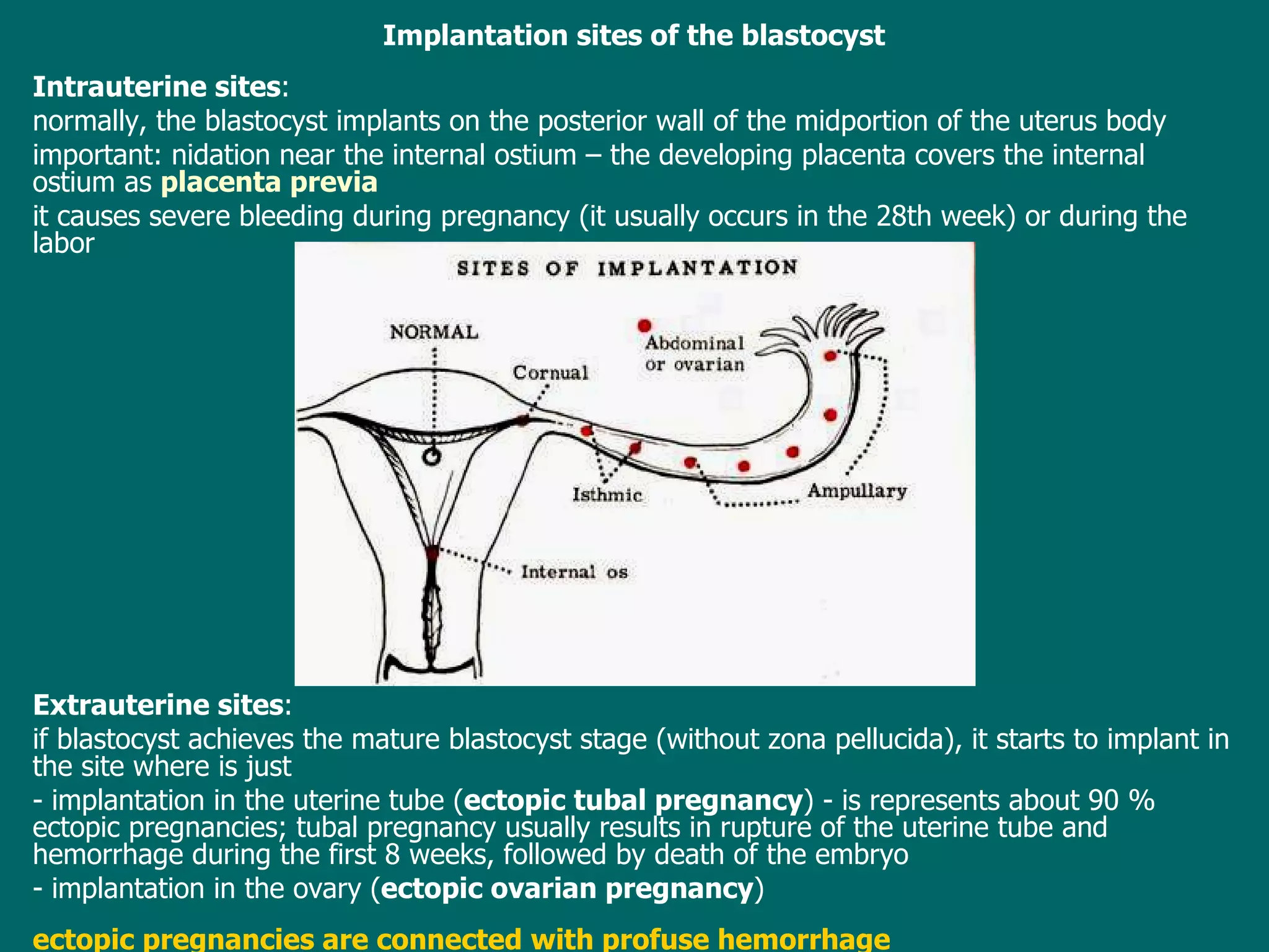 Lecture4 | PPT