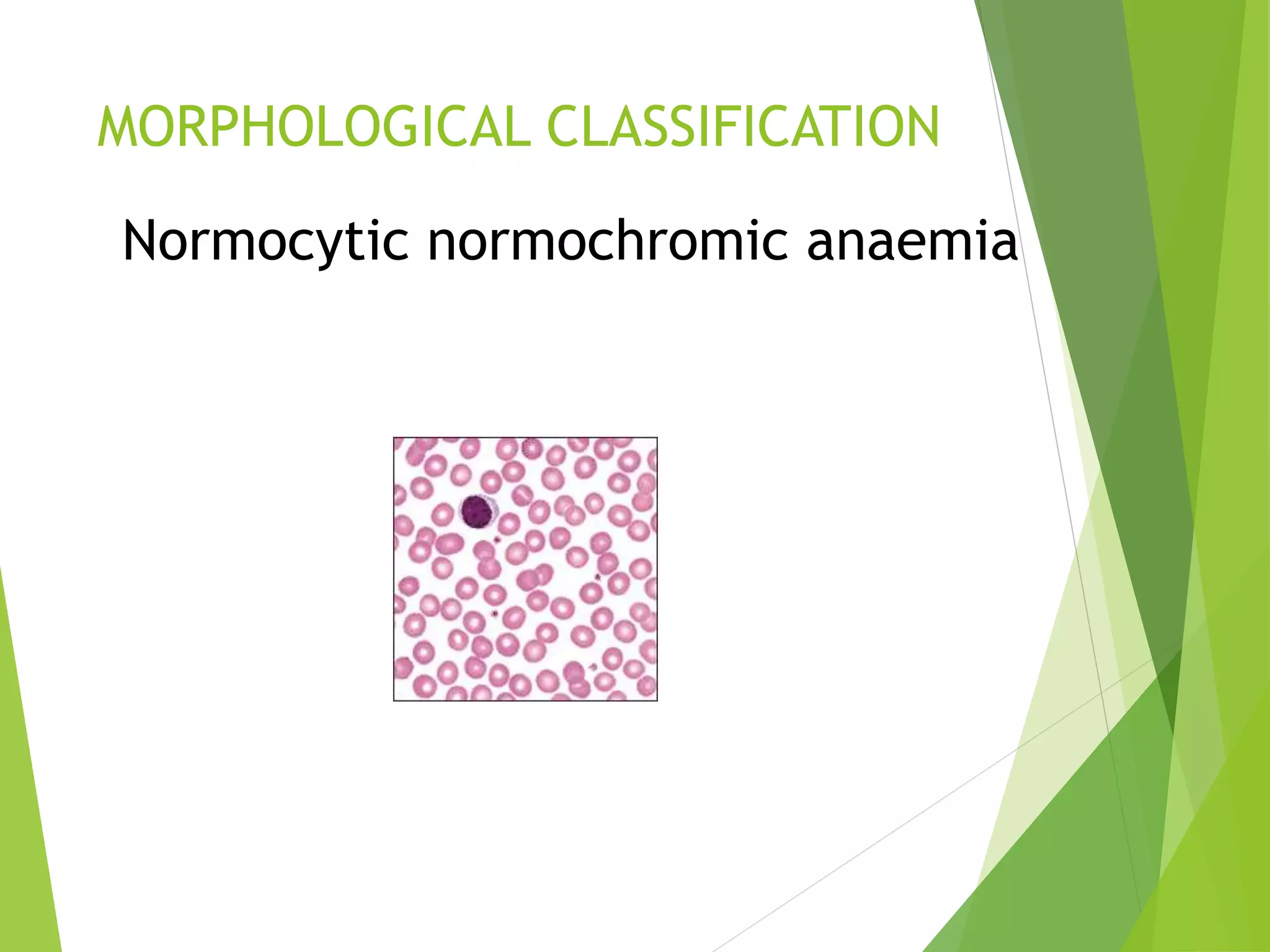 Lecture 4. classification of anemia | PPTX