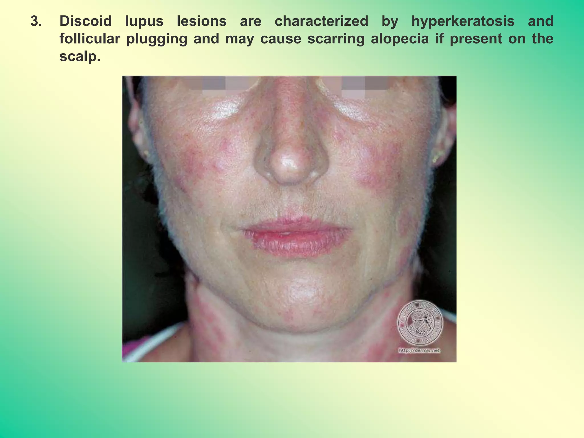 Systemic Connective Tissue Inflammatory Syndrome Lecture 4 | PPT