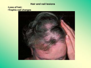 Systemic Connective Tissue Inflammatory Syndrome Lecture 4 | PPT