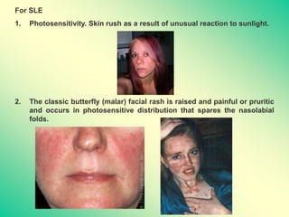 Systemic Connective Tissue Inflammatory Syndrome Lecture 4 | PPT | Skin ...