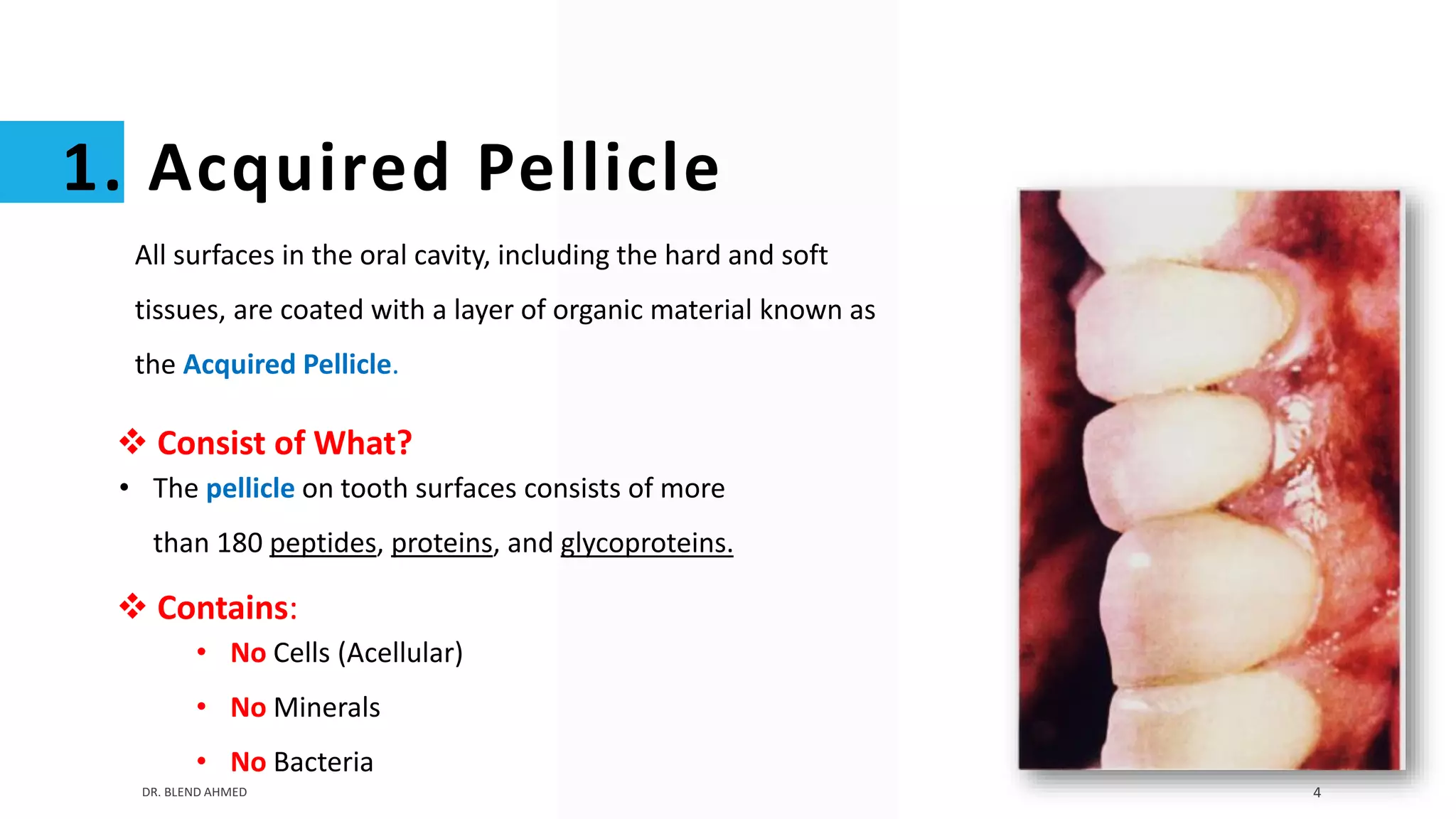 Deposits on the Teeth | PDF